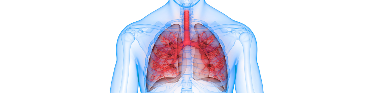 Chronisch obstruktive Lungenerkrankung (COPD) - Klassifikation ...
