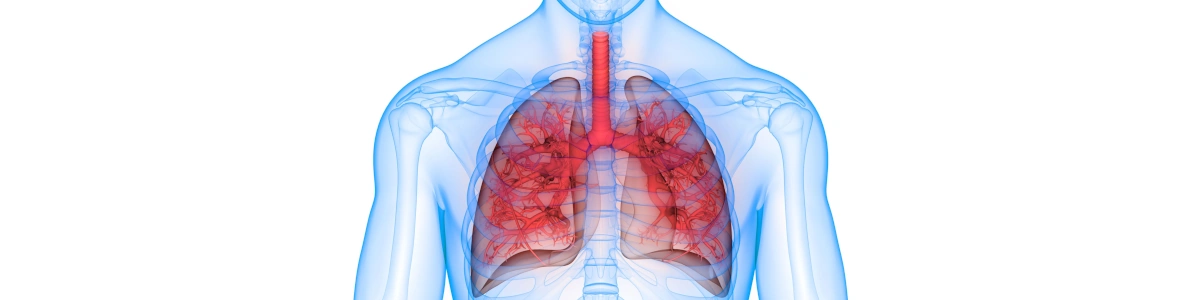 Vergiftungen (Intoxikationen) - Symptome – Beschwerden | DocMedicus ...